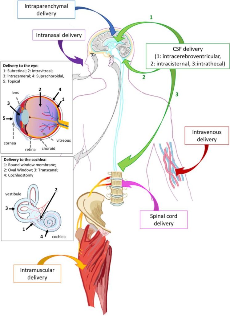 Differences in AAV Administration Routes in Clinical Applications for ...